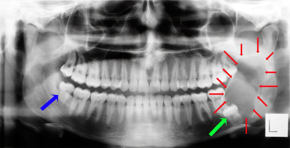 Dental Technology - Beyond Smiles Family Dental