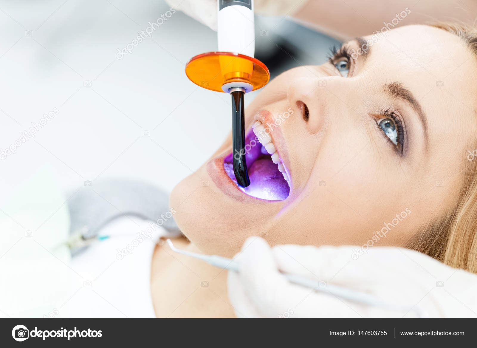 Tooth Whitening - Beyond Smiles Family Dental